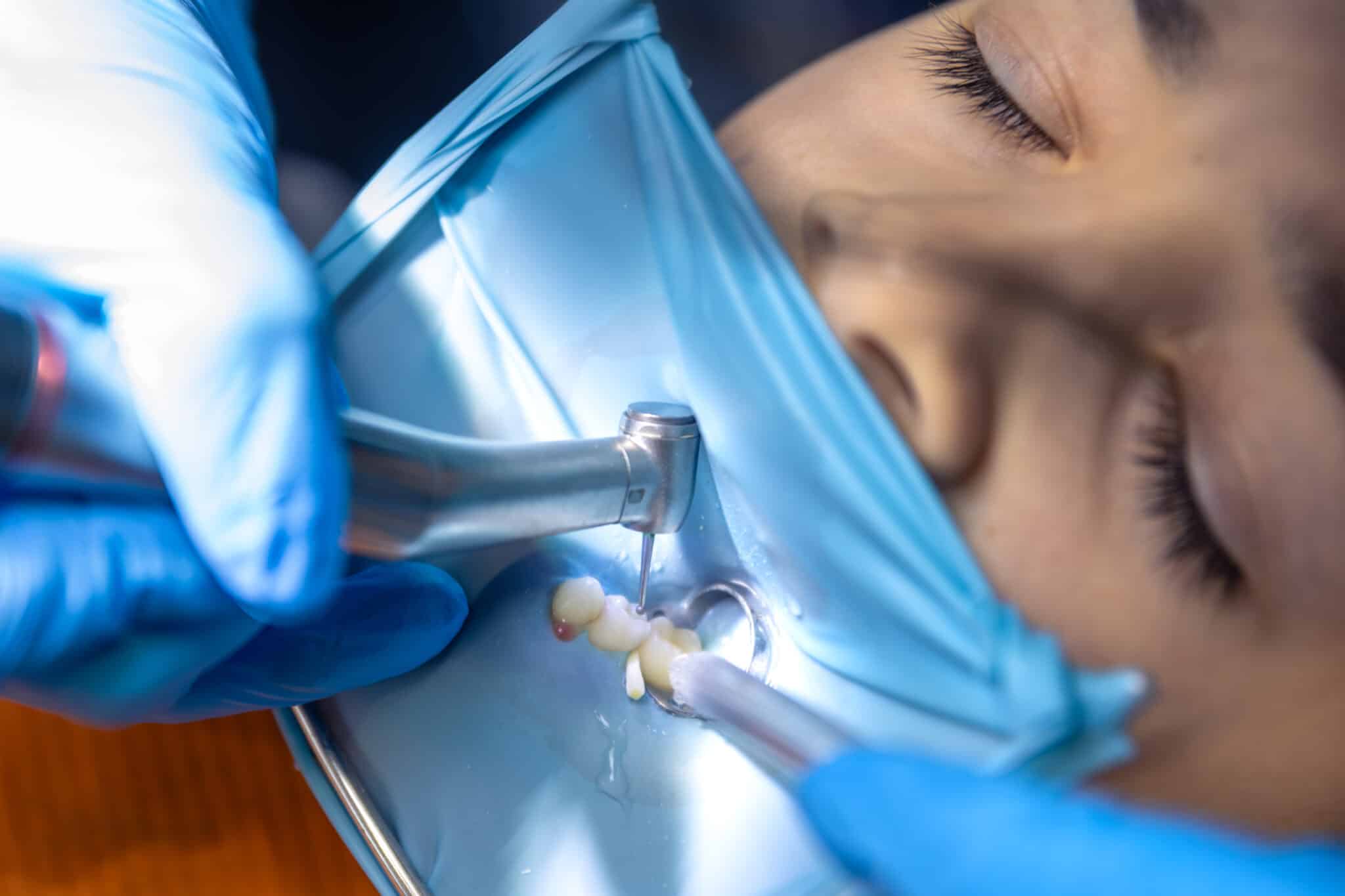Tooth Extractions in Murrells Inlet | Waccamaw Oral Surgery